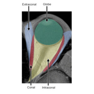 Aesthetic Orbital Surgery | Oculofacial Clinic TOKYO