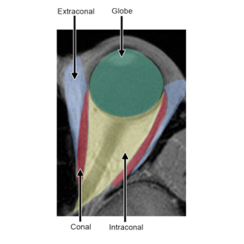 Cosmetic Orbital Surgery | Oculofacial Clinic TOKYO